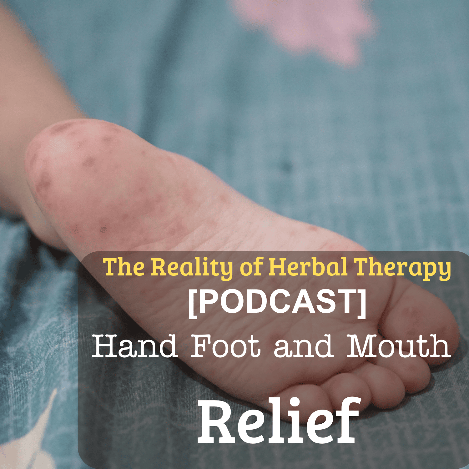 [Podcast] Hand, Foot & Mouth Relief: Herbal Hacks to Soothe Sores Fast